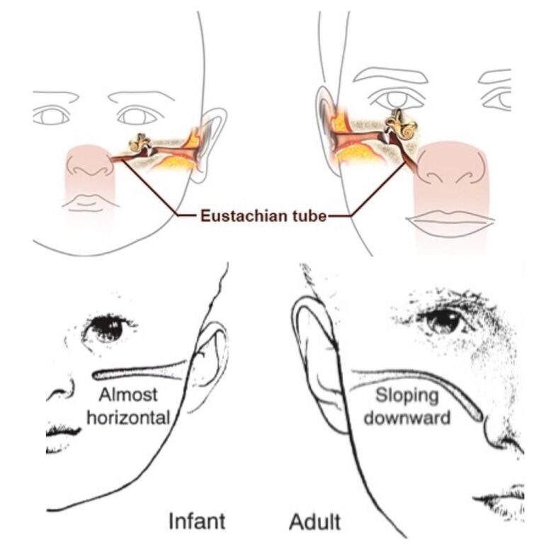 Ear Infection Radio Interview at Doctor's Orders - DWWW 774